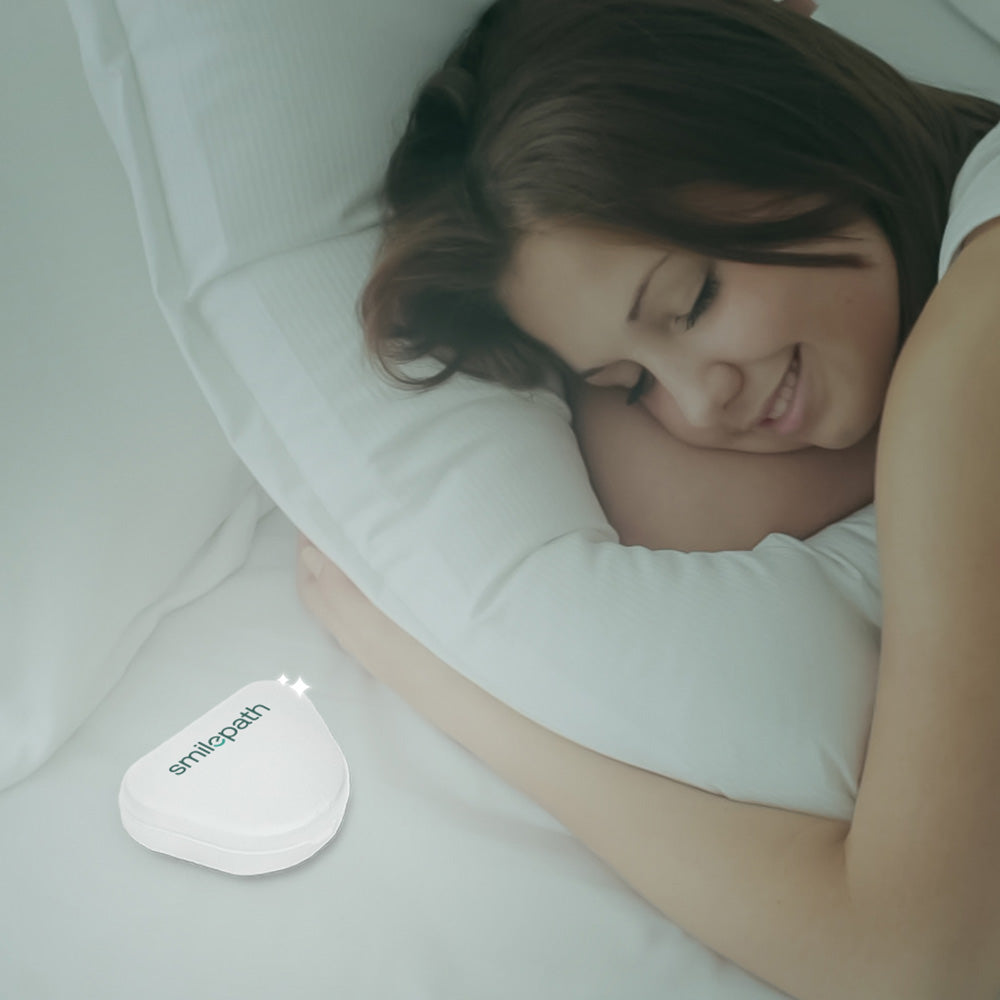 Custom Soft Night Guard - For Mild Teeth Grinding Relief