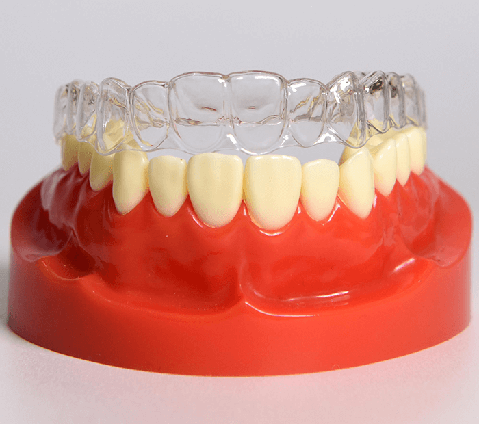 SmilePath Flex Easy Clear Aligner Plan for teeth straightening